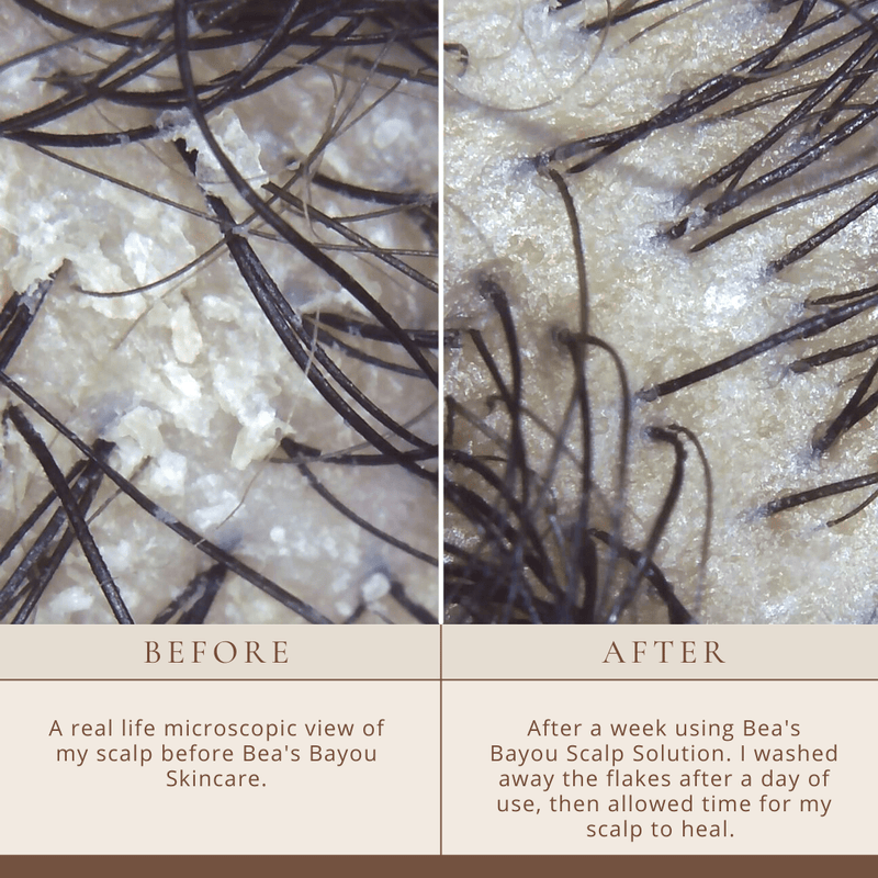 Home Prebiotic Scalp Relief Solution | Herbal Liquid Leave-in | Good ...